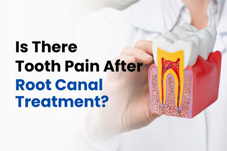 Is There Tooth Pain After Root Canal Treatment?