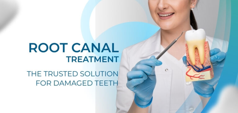 Root Canal Treatment: The Trusted Solution for Damaged Teeth